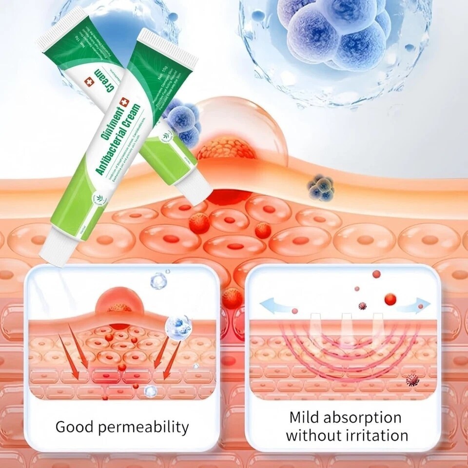 Antibiotic Cream for Skin Infection, Anti Itch Cream Soothing Ointment ...
