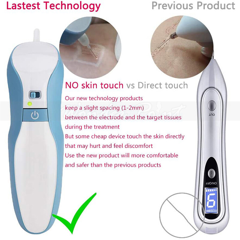 Maglev Plasma Pen Eyelid Lifting Laser Fibroblast Spot Removal Skin ...