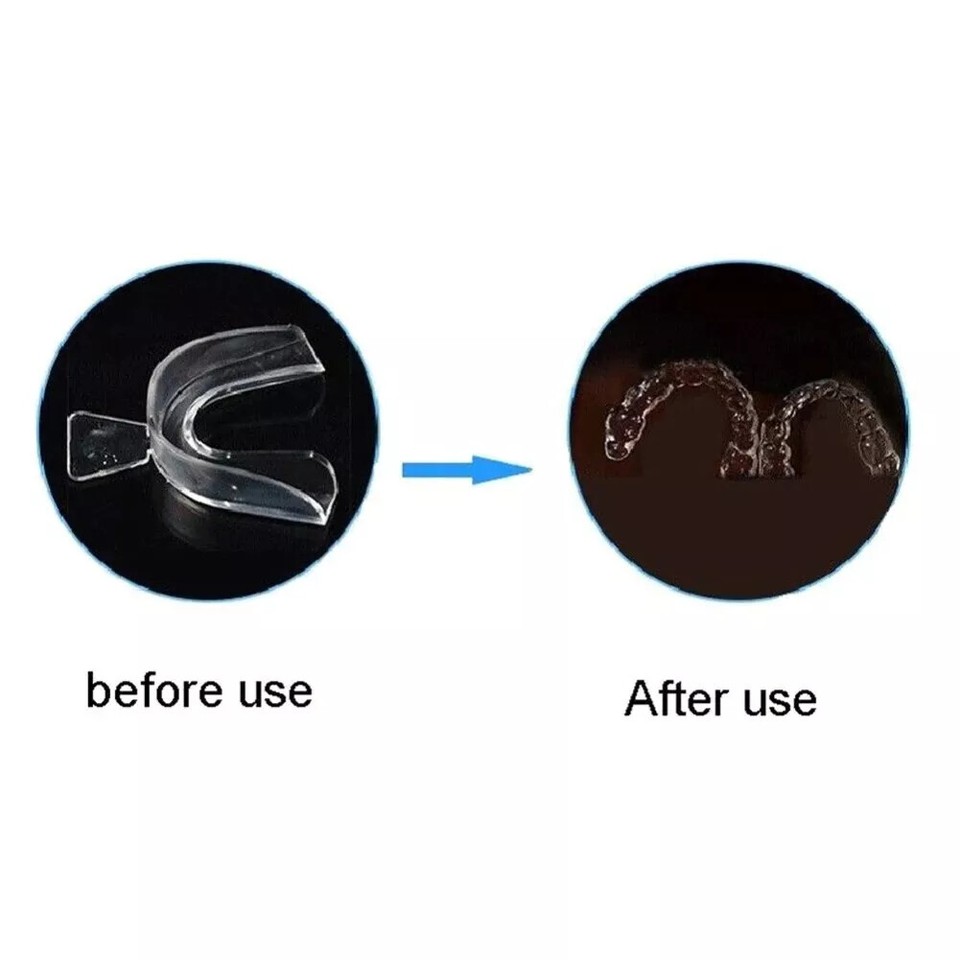 New Orthodontic Retainer Fixed Teeth Corrector Retainers 2/4pairs ...