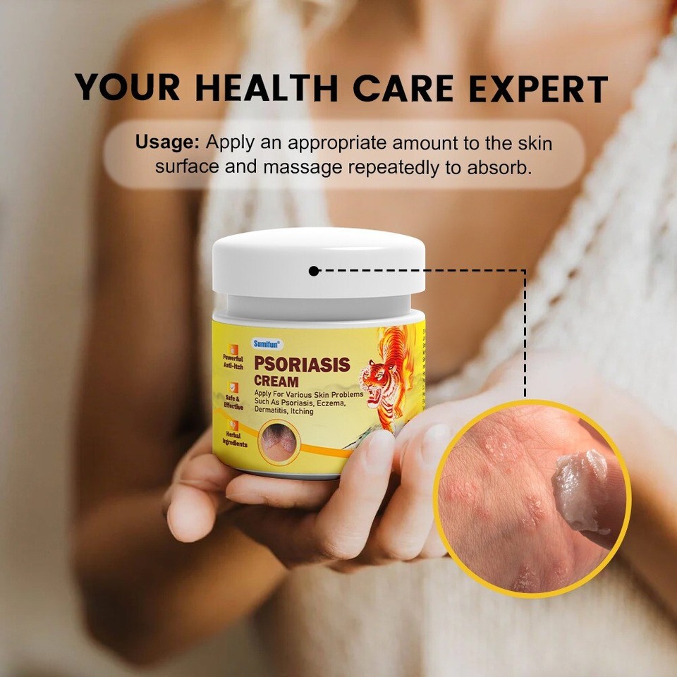 20G Psoriasis Cream Anti-bacterial Cream Skin Care Cream for Topical ...