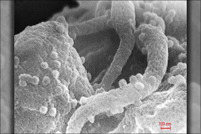 Poster, Many Sizes; Scanning Electron Microscope Image Hiv Aids Virus ...