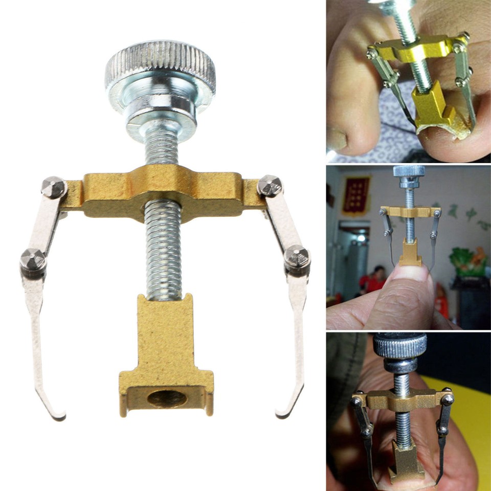Ingrown Toenail Manicure Pedicure Foot Care Correction Brace Tool Toe ...