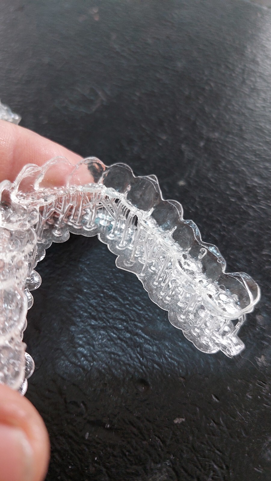 DLP SLA LCD 3d printer CLEAR ALIGNER resin | eBay