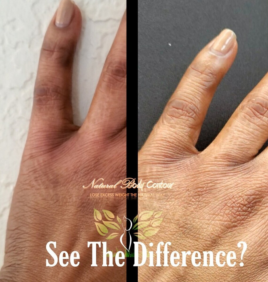 Dark knuckles cream, Skin lightening, Dark hands, Natural lightening | eBay