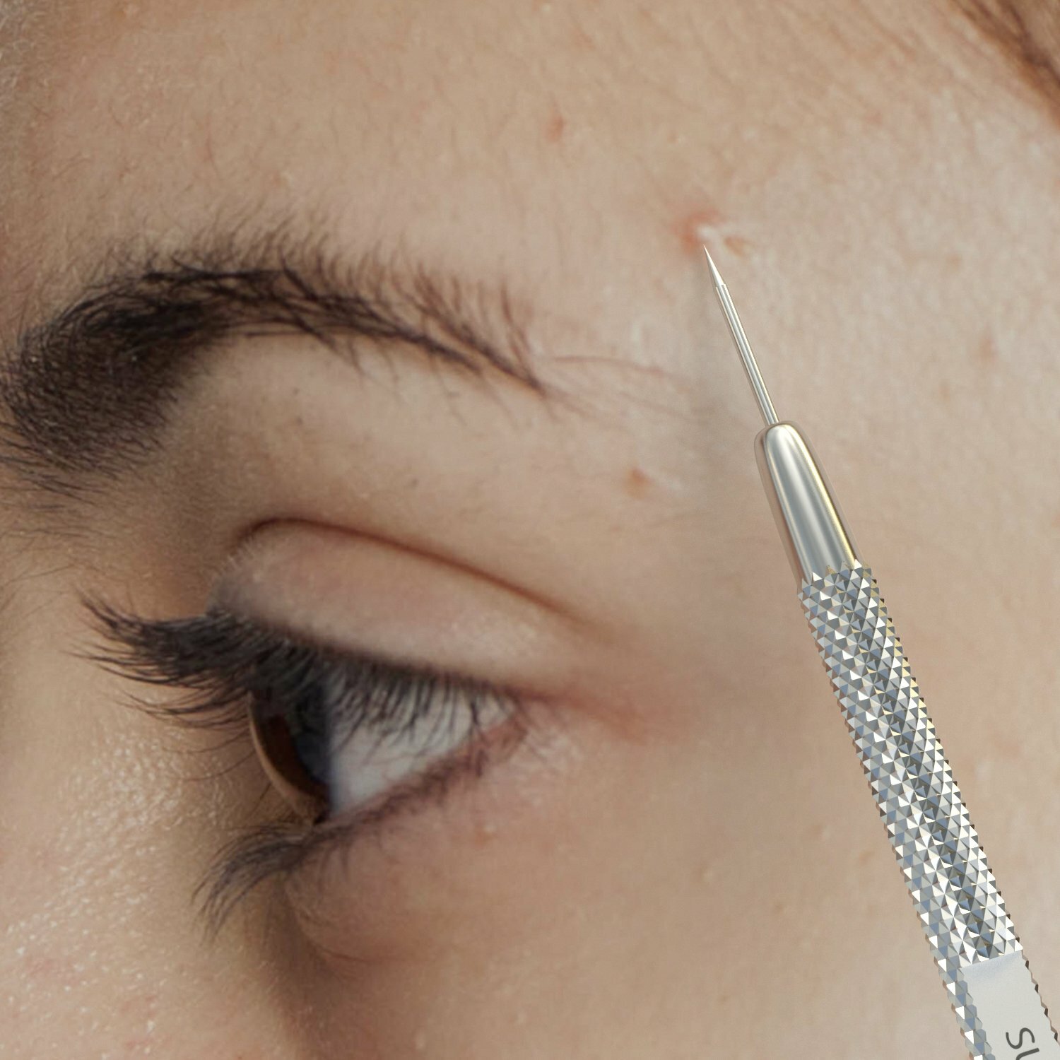 Milia Removal Needle