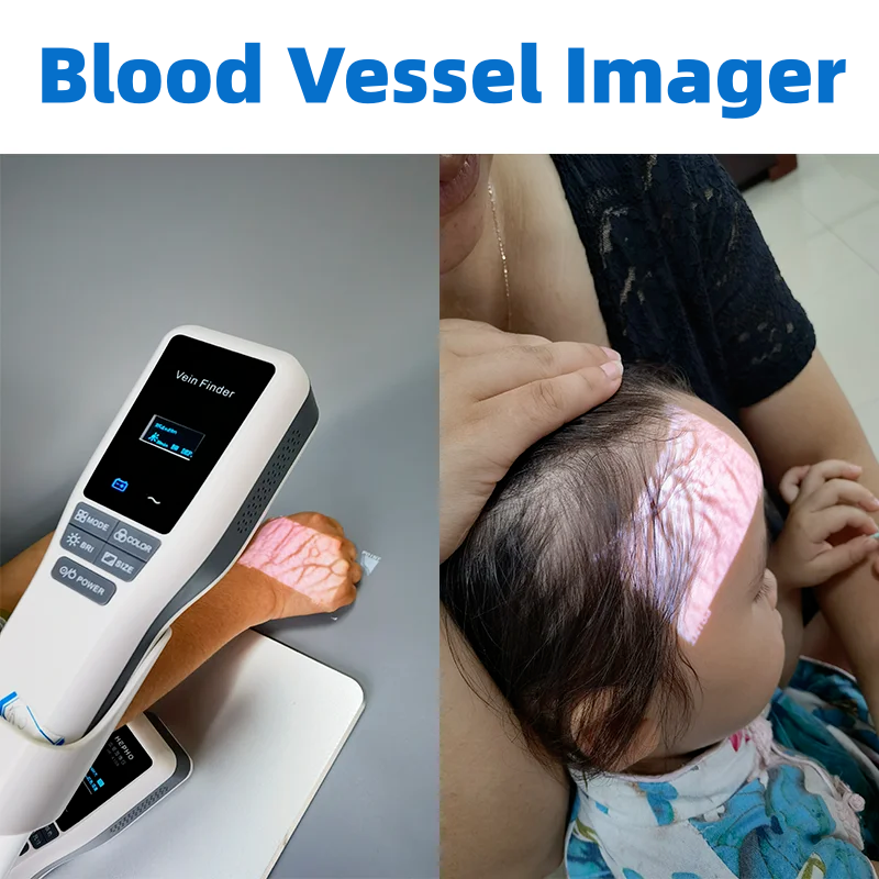 Vein Finder Locator Handheld Portable Near-Infrared Blood Vessel ...