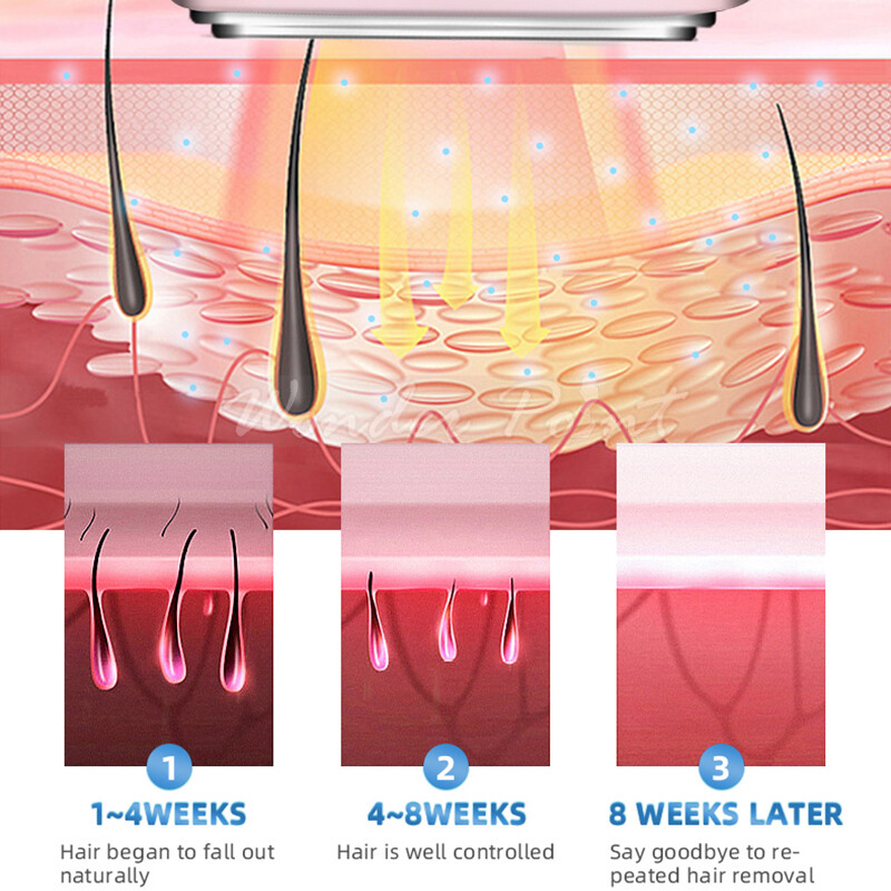 Mlay T4 IPL Laser Permanent Hair Removal Epilator Remove Moustache ...