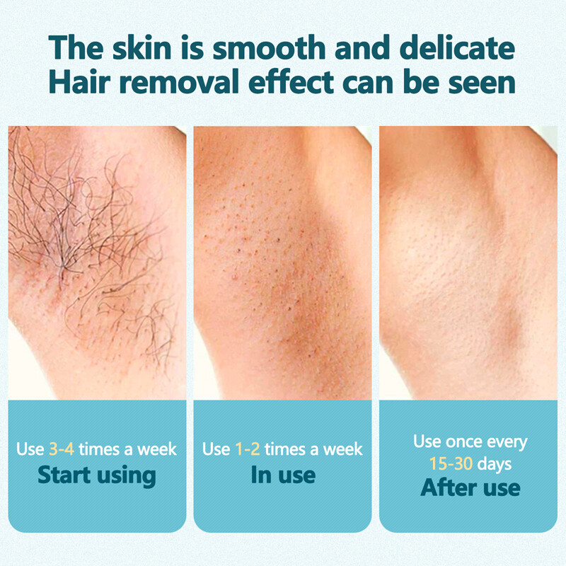 990000 IPL Laser Hair Removal Epilator Permanent Full Body Hair Removal ...