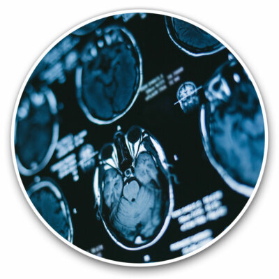 2 x Vinyl Stickers 15cm - MRI Brain Scan X-Ray Images Cool Gift #21825 ...
