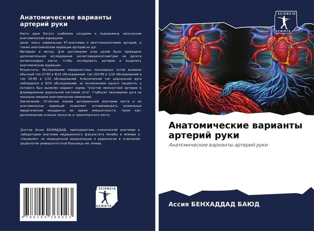 Anatomicheskie Warianty Arterij Ruki von Assiq Benhaddad Bajud (2021 ...