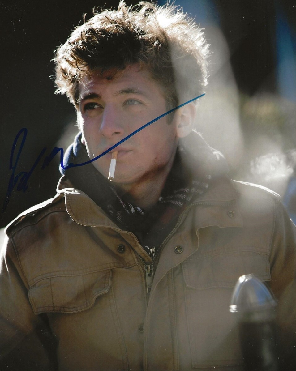 Jeremy Allen White Lip Gallagher