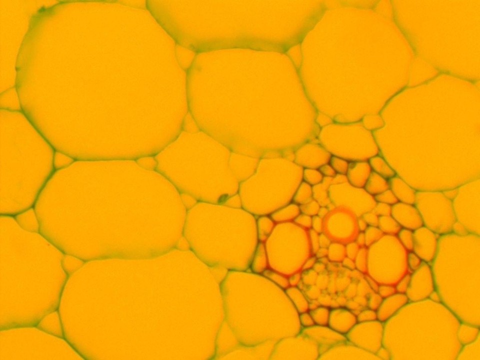 OMAX 5 Mega Pixel Digital USB Microscope Camera w Software and ...