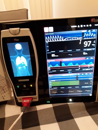 Masimo Root Monitor with: Rad 7, SpHb, SpCo, Co2 Isa, PVI,SedLine, wifi ...