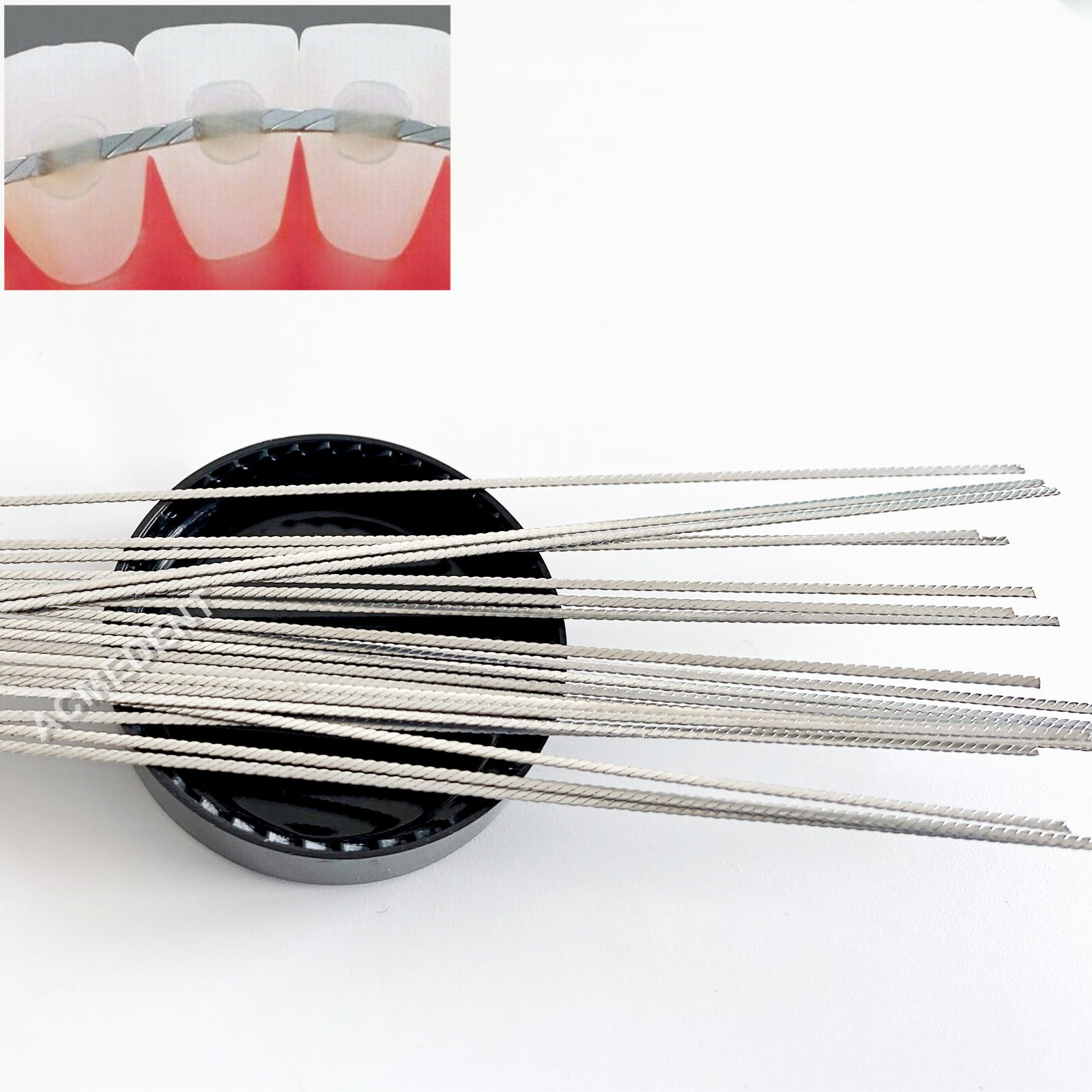 Dental Lingual Retainer Twist Wire Flat Twisted Wires Orthodontic ...