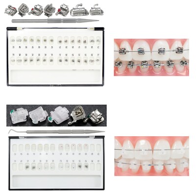 Dental Ormco Damon Brackets Orthodontic Self Ligating Ceramic Metal ...