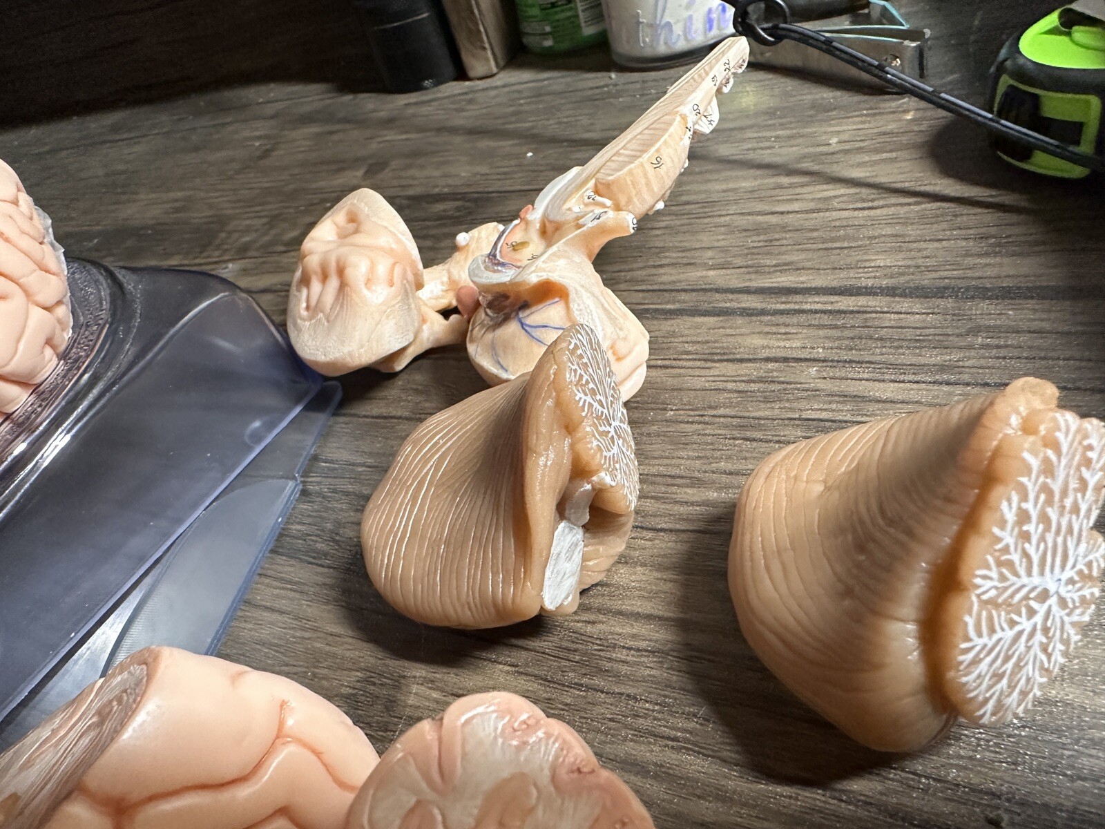 Somso Anatomical Brain Model 8 part numbed Bs20 Doctor Surgeon Lear ...