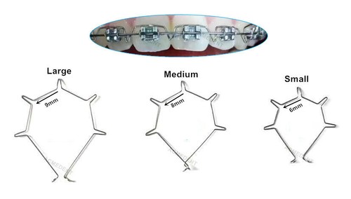 Dental ART Root Torque Springs Orthodontic Spring 5 Loops Curved ...