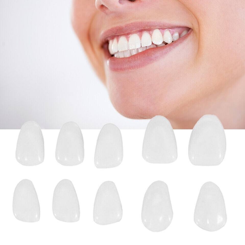 Dental Temporary Crown Veneers for Anterior Front Teeth Whitening 70Pcs ...