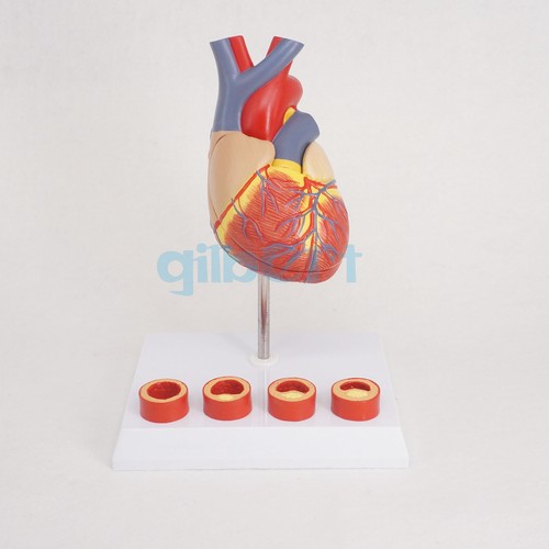 Life Size Human Anatomy Model With 4 Stage Vascular Mounted on White ...