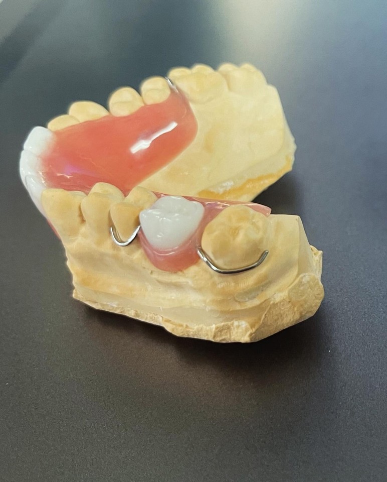 DIY Denture Kit Complete Custom Denture Temp Teeth Acrylic Partial | eBay