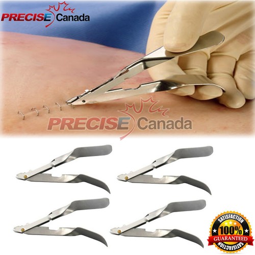5PC Suture/Staple Remover - For Skin Staple - Sterile Disposable ...