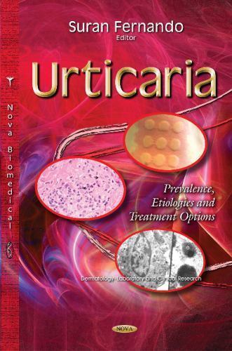 Urticaria : Prevalence, Etiologies and Treatment Options by Suran ...