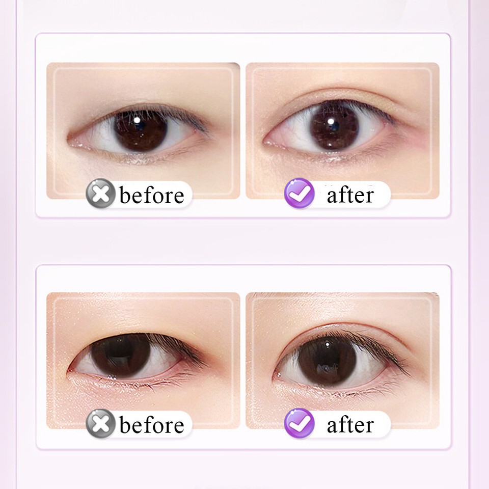 240pcs Waterproof Adhesive Invisible Double Eyelid Patch Lace Eye ...