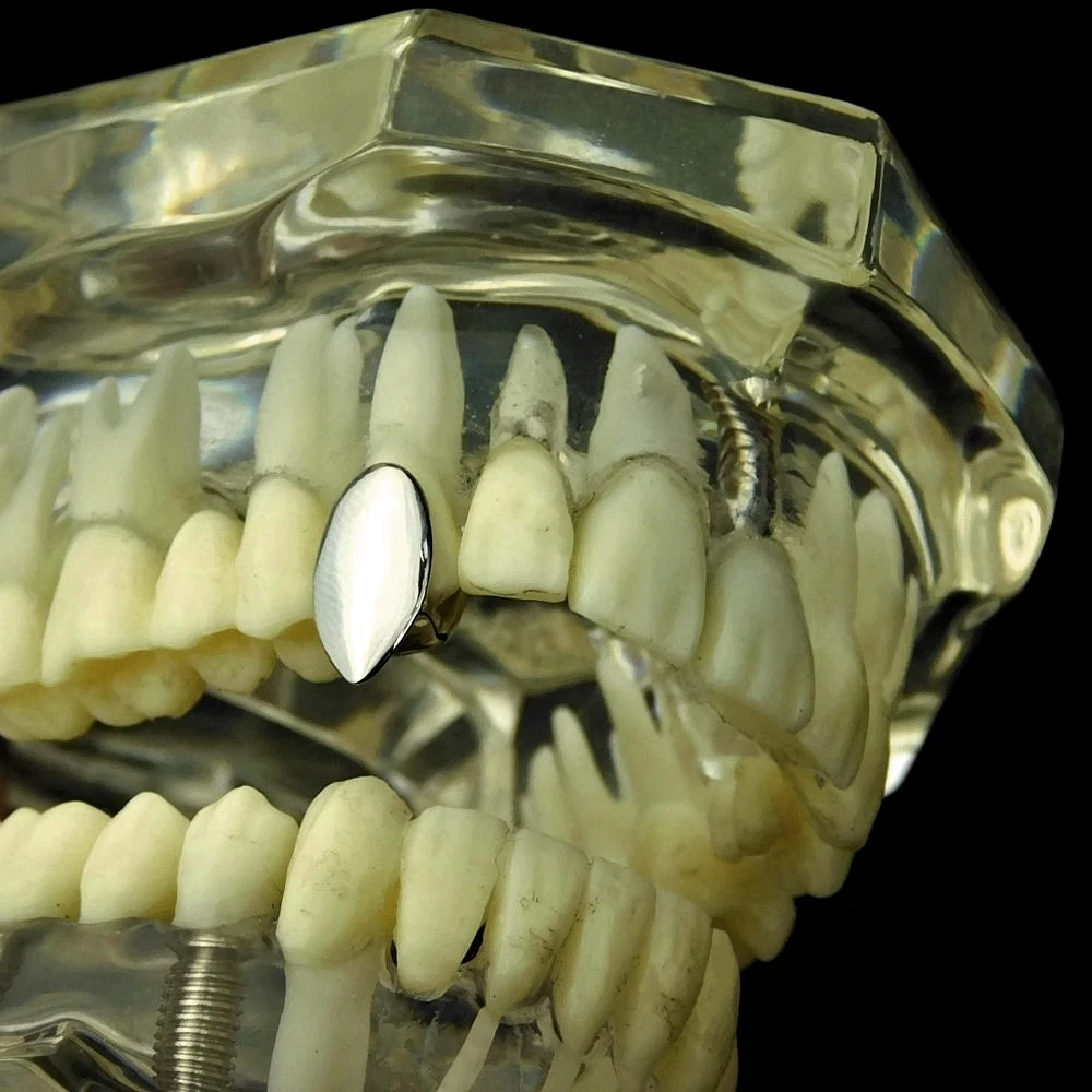 Silver Canine Tooth Cap