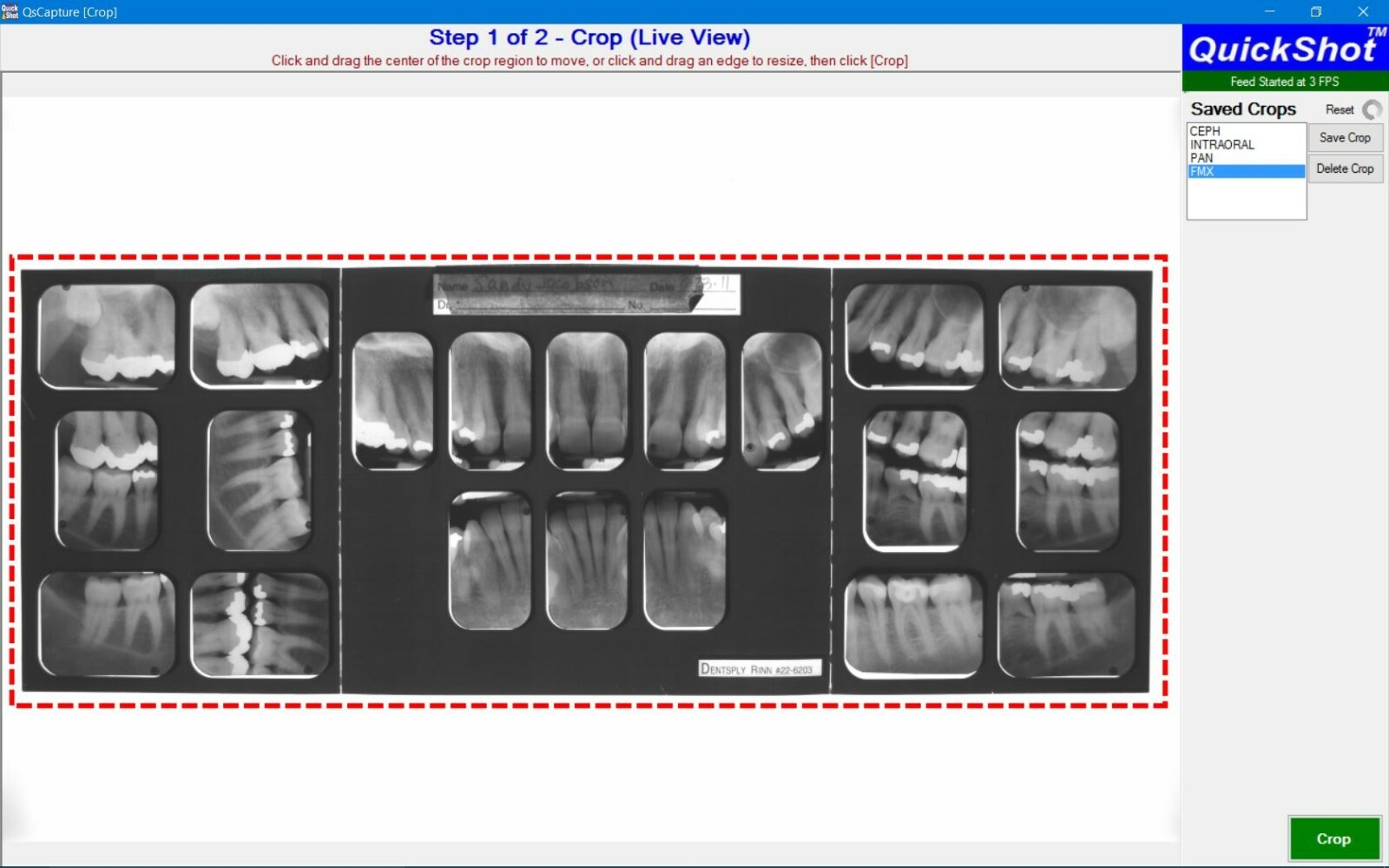QuickShot QS-330 Instant X-Ray Film Digitizer / Scanner. X-ray film to ...