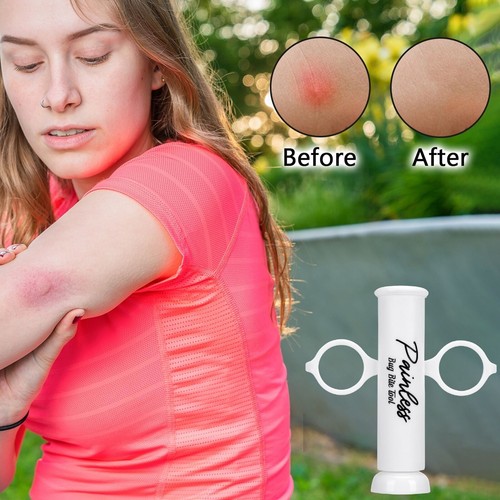 Bug Bite Thing Suction Aid Poison Remover - Insect Bites and Bee Wasp ...