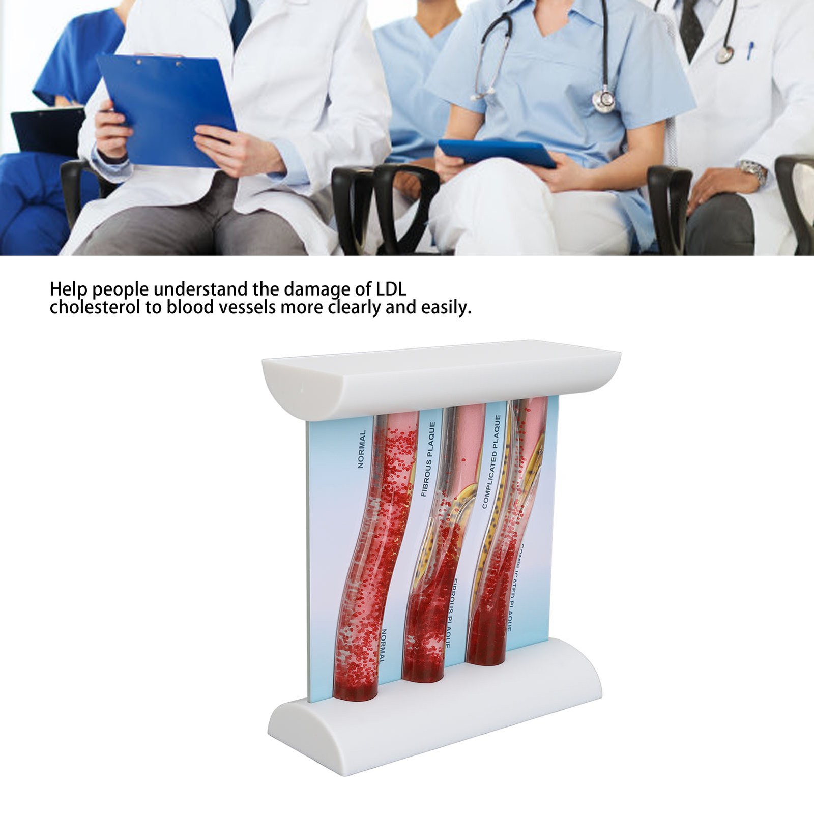 Lipoprotein LDL Blood Vessel Model Low Density Blood Lipid Vessel IDS ...