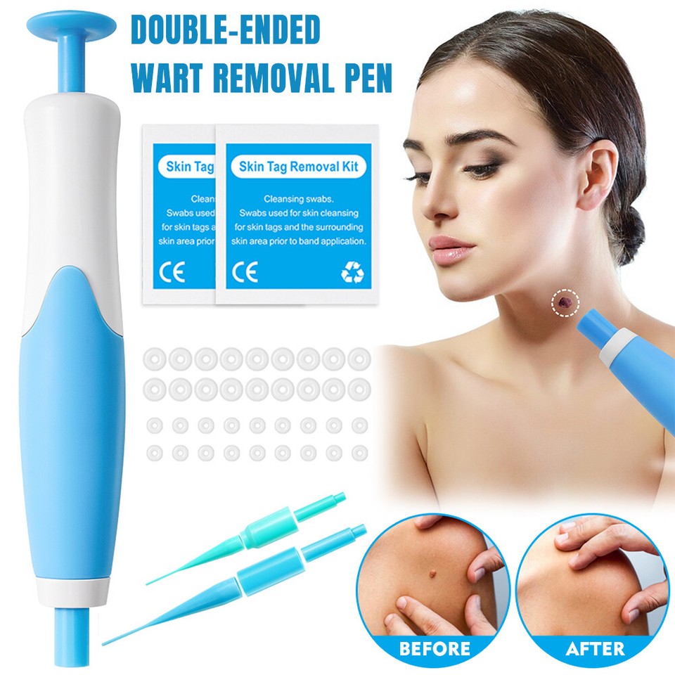 2 in 1 Natural Painless Auto Skin Tag Removal kit Skin tag bands ...