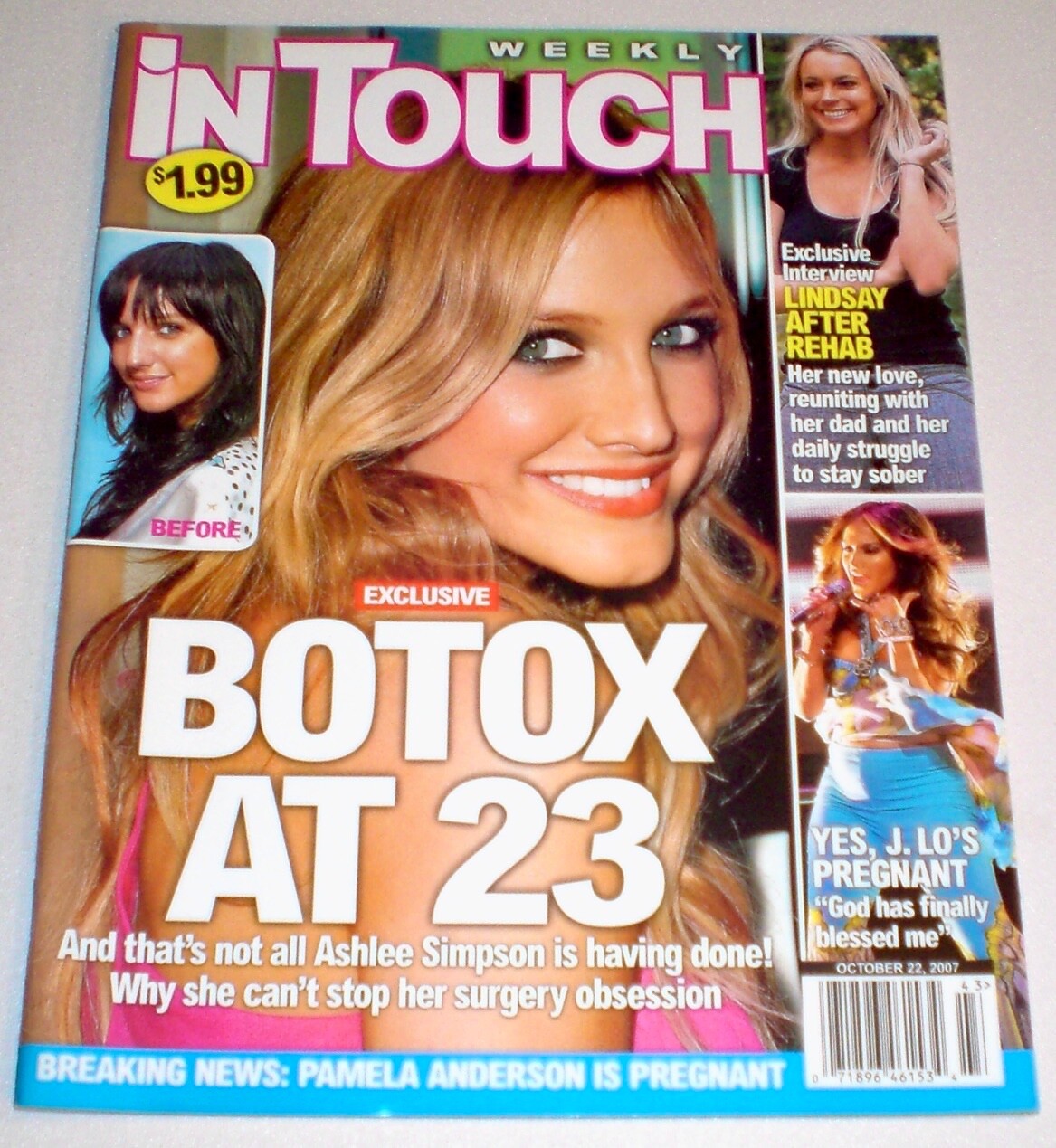 Botox Magazine Advertisement