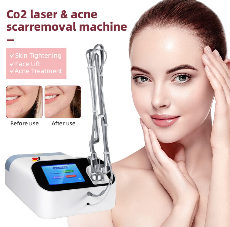 Co2 Radio-frequency Tube Combined Fractional Laser Machine FAcne Scars ...
