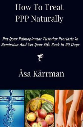 How to Treat PPP Naturally : Put Your Palmoplantar Pustular Psoriasis ...
