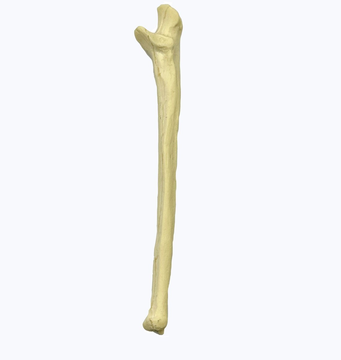 Ulna Unlabeled