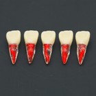 5Pcs Dental Endodontic Root Canal RCT Practice Pulp Cavity Endo Teeth ...