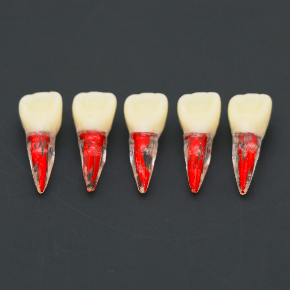 5Pcs Dental Endodontic Root Canal RCT Practice Pulp Cavity Endo Teeth ...