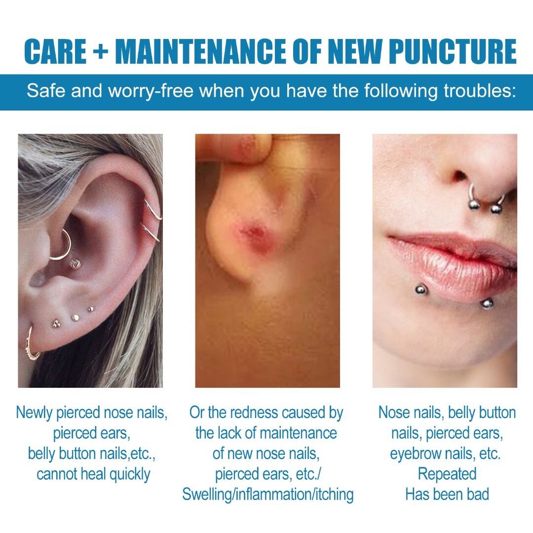 Keloid Belly Button Piercing