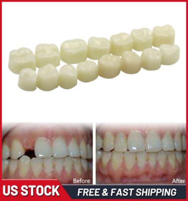 50/70Pcs Temporary Teeth Crowns Resin Posteriors Anterior Molar Tooth ...