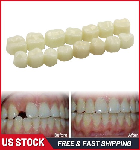50/70Pcs Temporary Teeth Crowns Resin Posteriors Anterior Molar Tooth ...