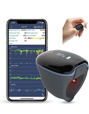 Wellue O2Ring™ Wearable Ring Oxygen Monitor- O2 Ring | eBay