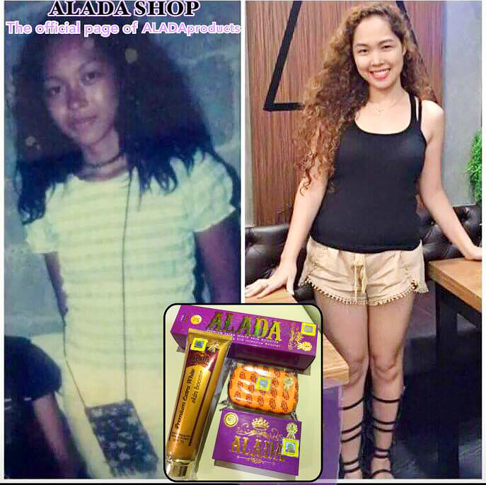 ALADA Super Fast Whitening Skin x10 Soap & Booster Lotion Set (USA 🇺🇸 ...