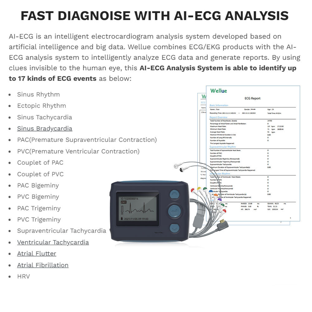 12 lead Holter ECG Monitor 24 hrs Recording ECG Data AI Analysis via PC ...
