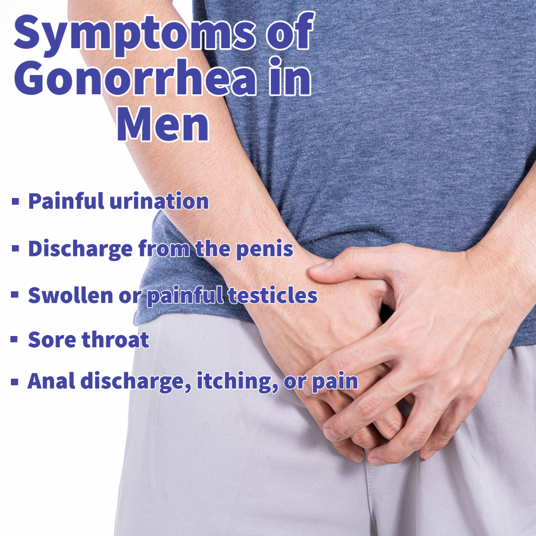 Gonorrhea In Males Male Gonorrhea, Medical Concept Stock Illustration