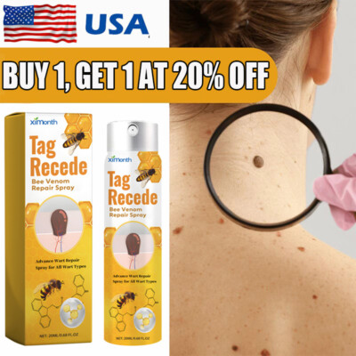 Tag Recede Bee Venom Treatment Spray Tag Recede Bee Venom Spray for All ...