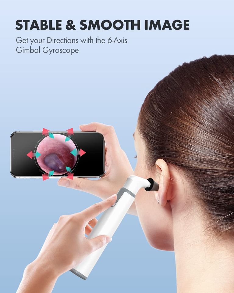 Wireless Otoscope Ear Camera with Dual View, 3.9Mm 720PHD Wifi Ear ...