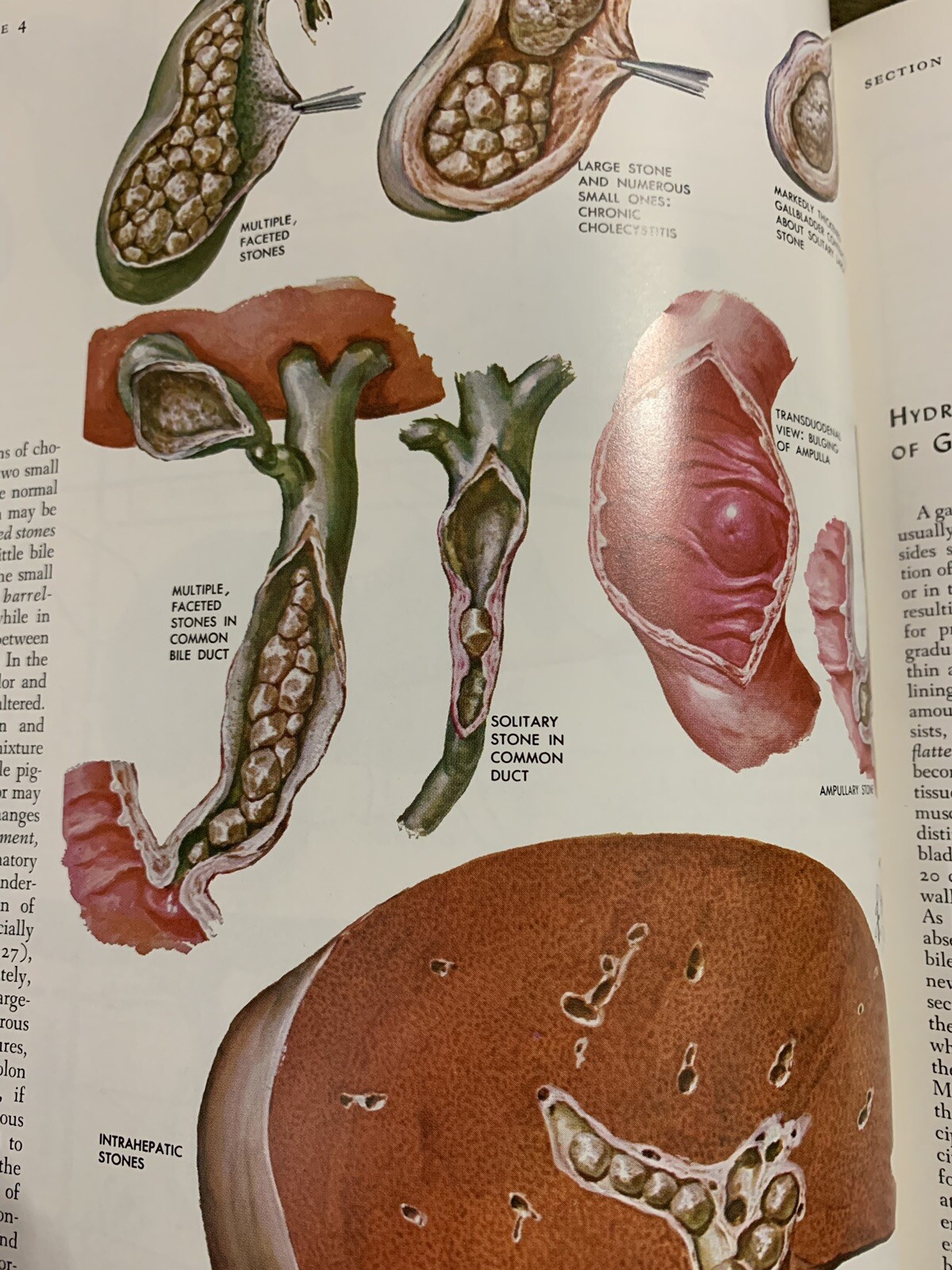 VTG Frank Netter The CIBA Collection Of Medical Illustrations Vol 3 ...