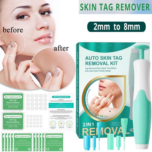 2in1 Painless Skin Tag Bands Remover Natural Mole Wart Removal Kit Auto ...