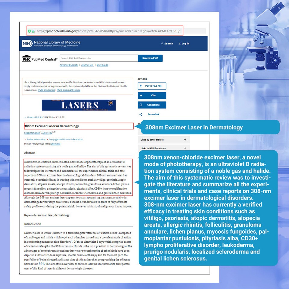 308nm Excimer Blue Uvb Light Therapy Phototherapy for Skin Diseases ...